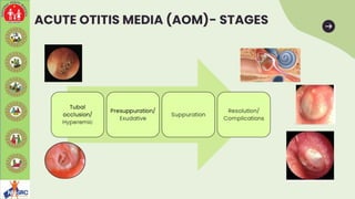 ENT Care for MO- Management of Common Ear Disorders.pdf