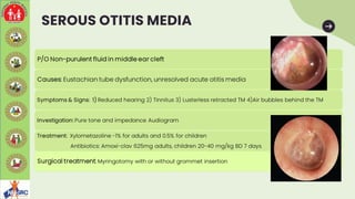 ENT Care for MO- Management of Common Ear Disorders.pdf