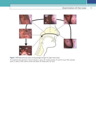 The ENT history and examination | PDF