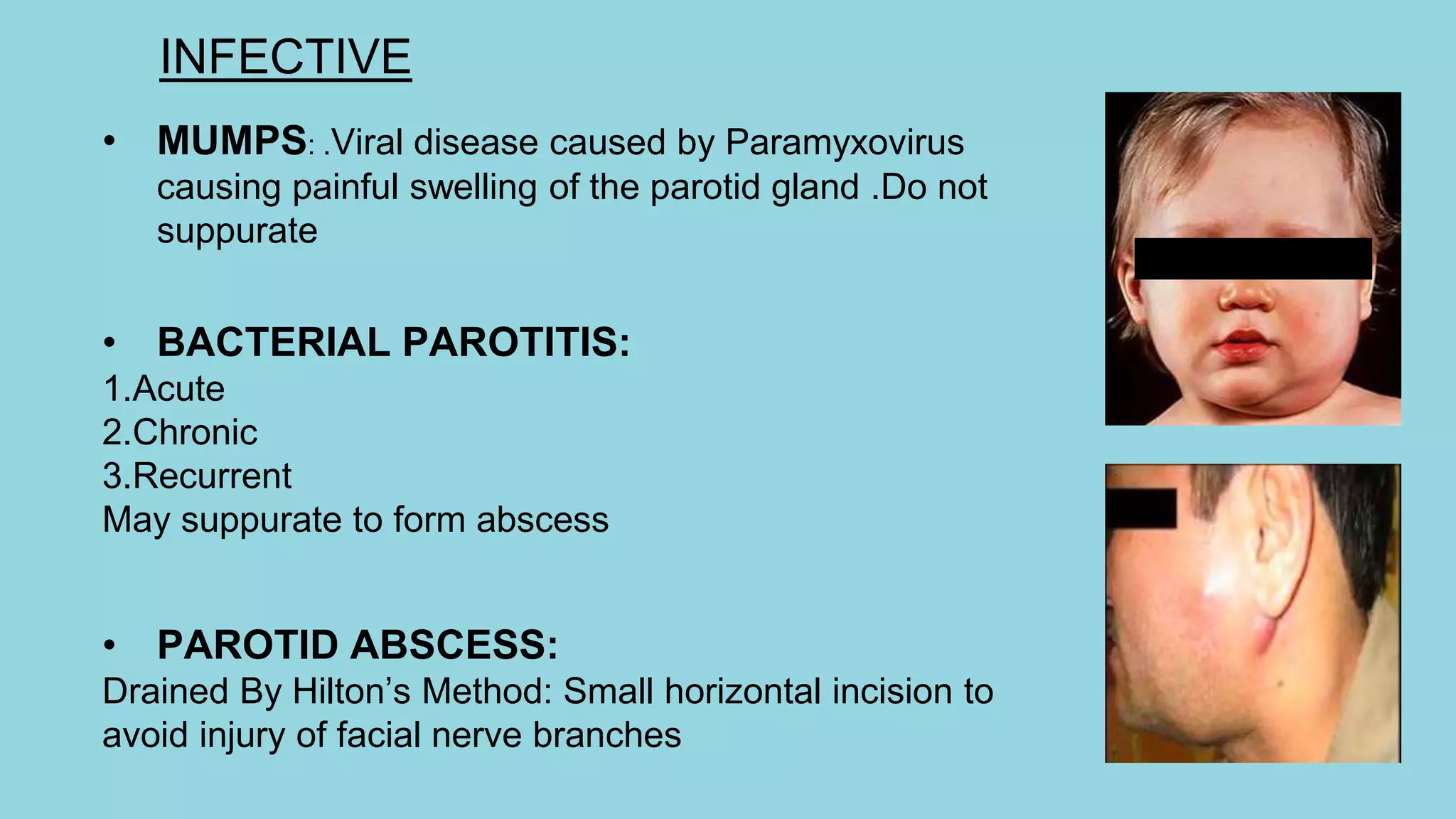 Parotid Gland ( Case and Basic Anatomy) | PPTX