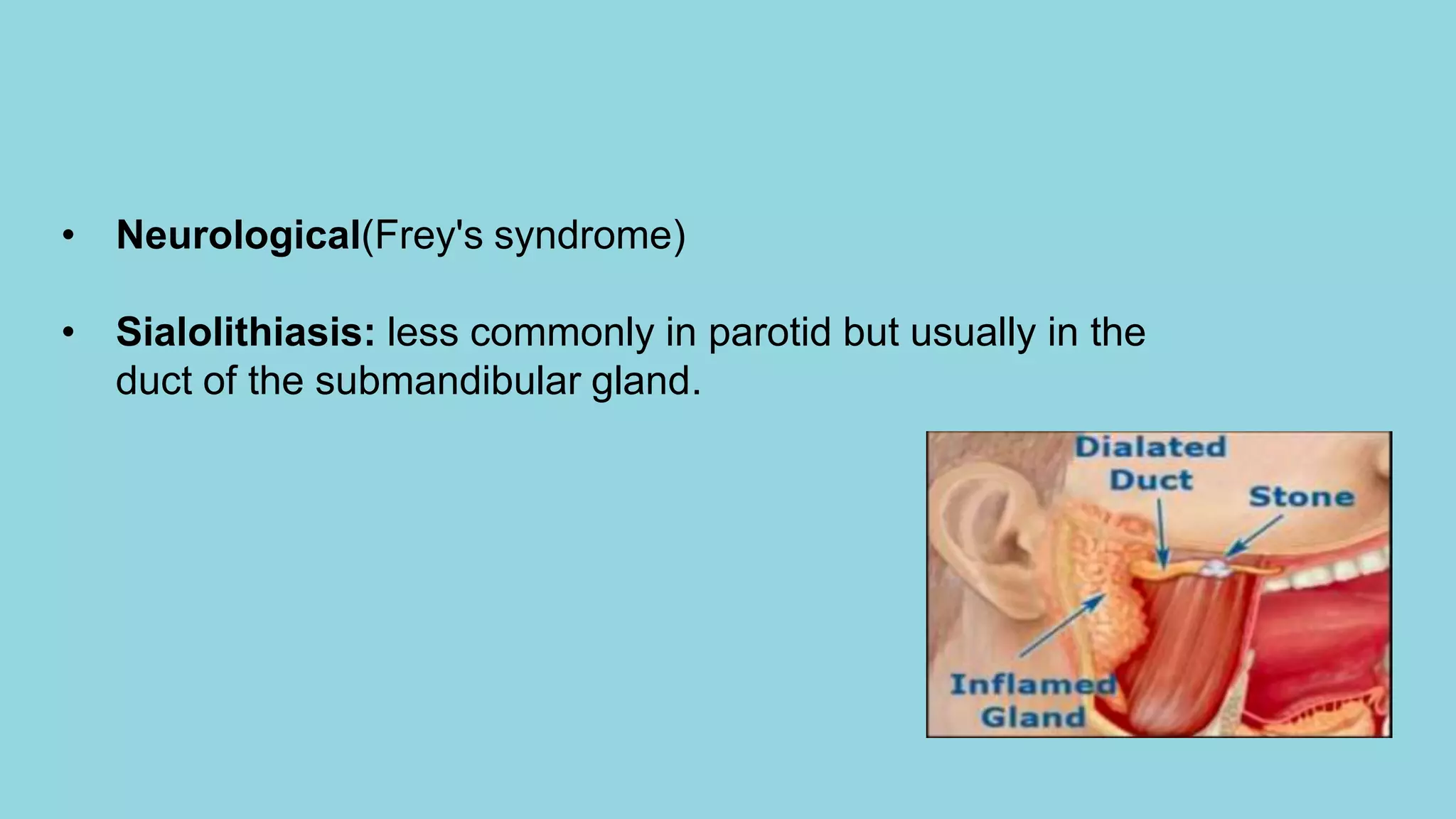 Parotid Gland ( Case and Basic Anatomy) | PPTX