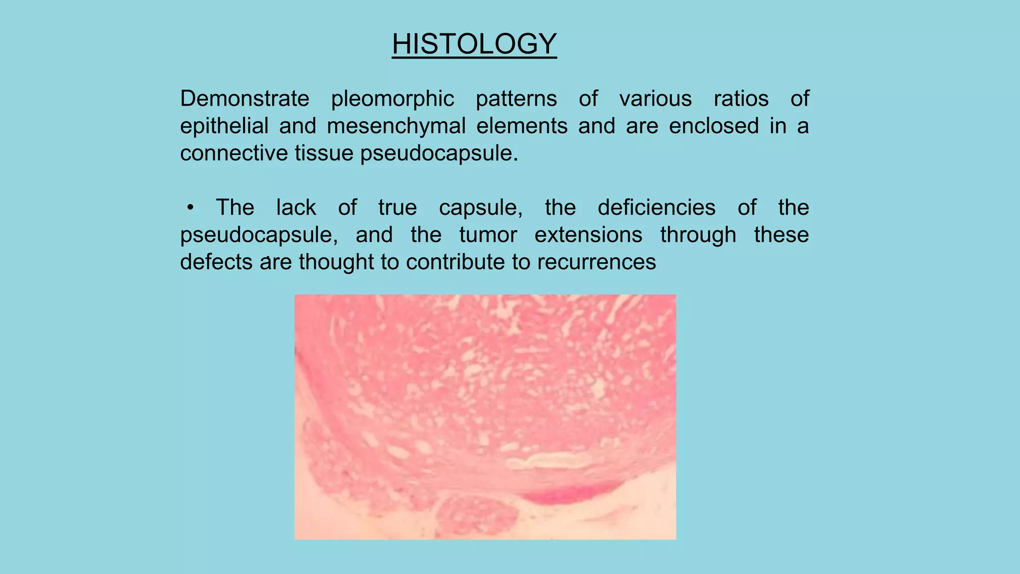 Parotid Gland ( Case and Basic Anatomy) | PPTX
