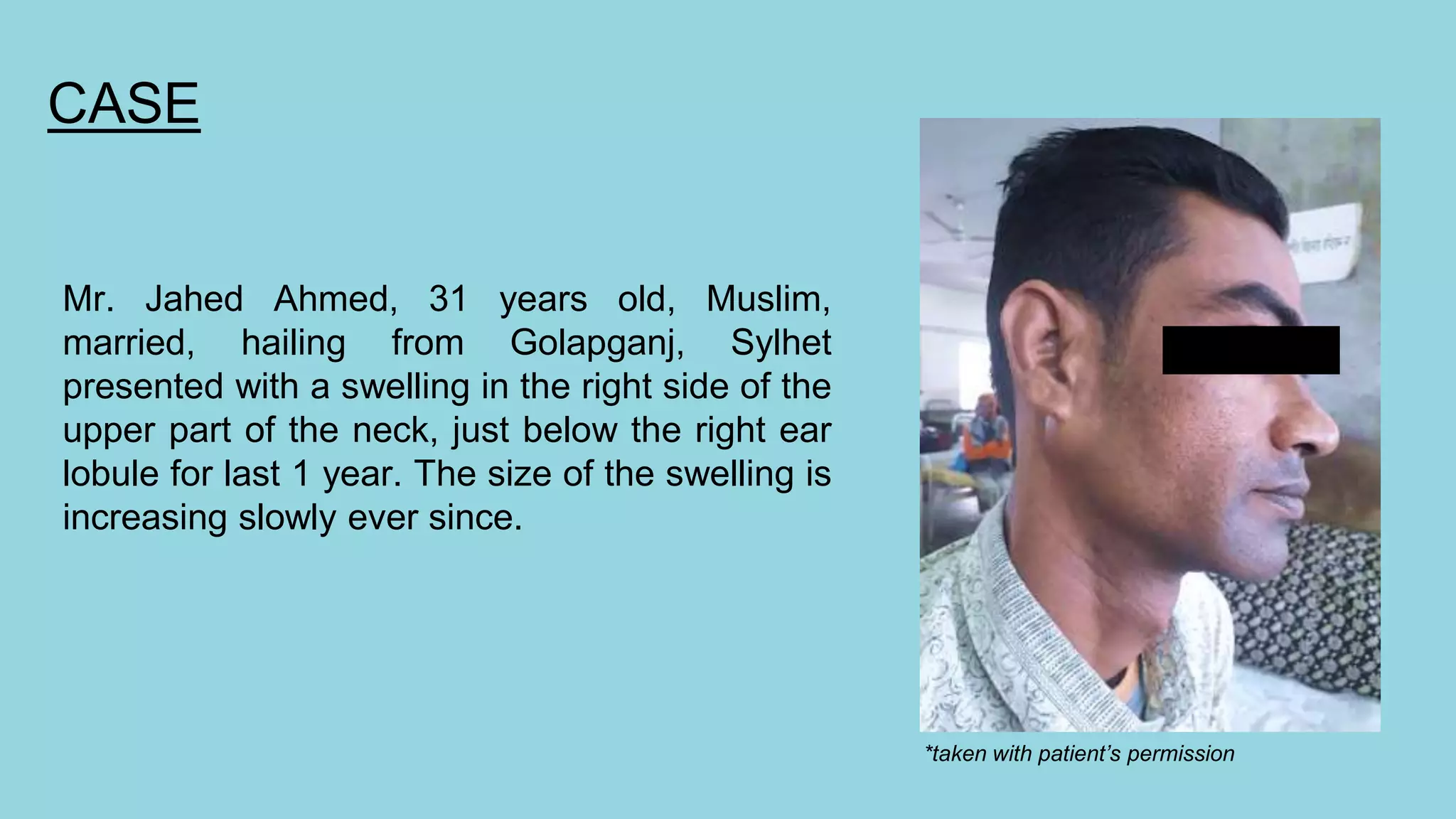 Parotid Gland ( Case and Basic Anatomy) | PPTX