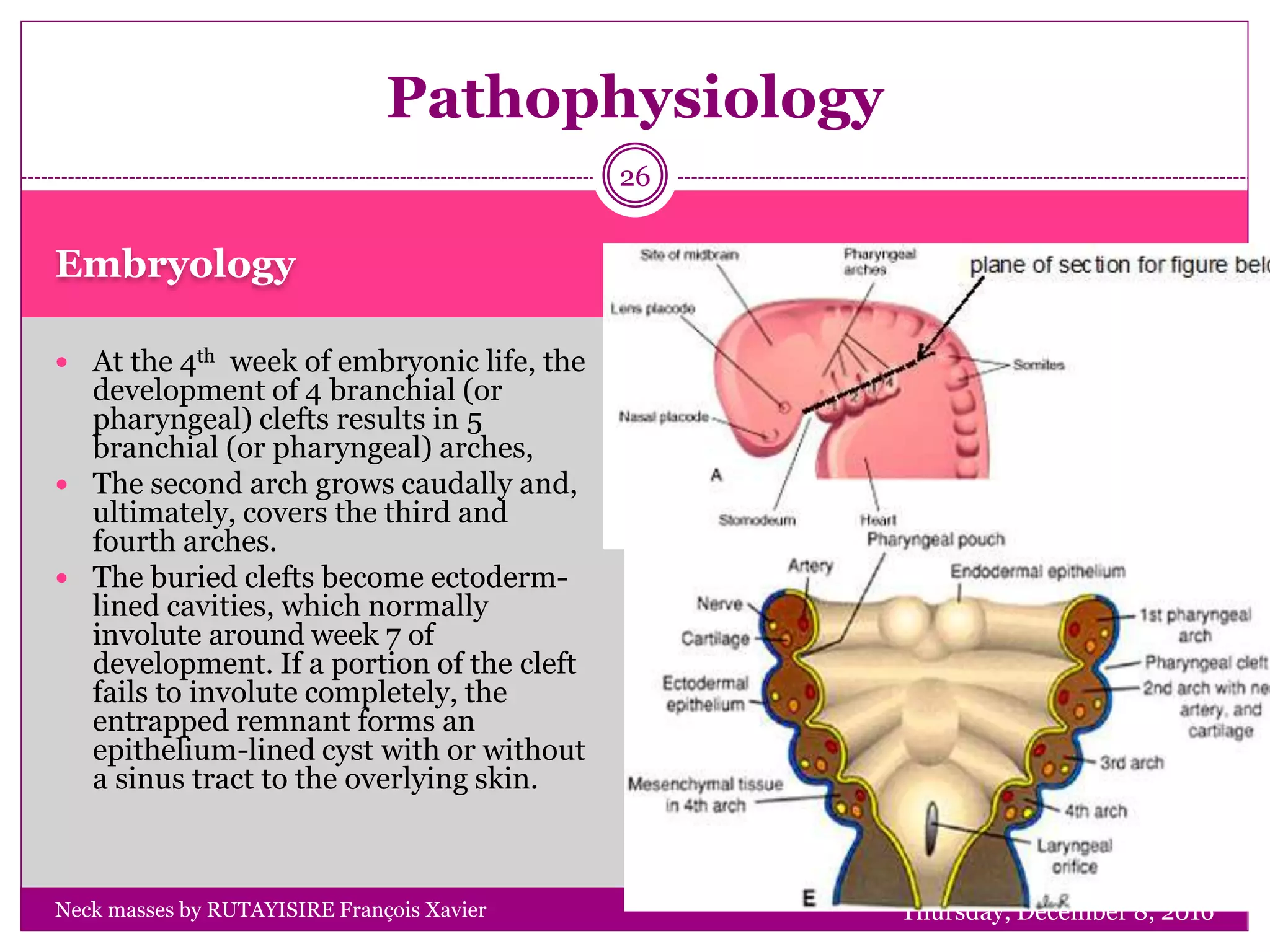 Ent clinical rotation presentation neck masses by xavier | PPTX