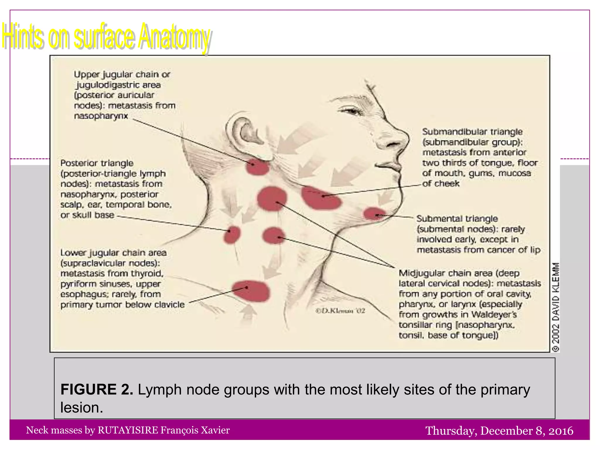 Ent clinical rotation presentation neck masses by xavier | PPT