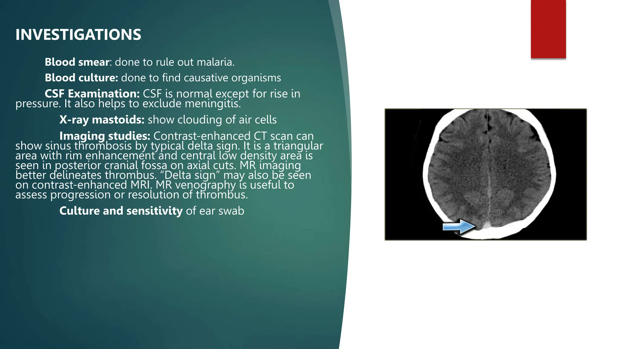 Lateral sinus thrombloplebitis and otitic hydrocephalus | PPTX