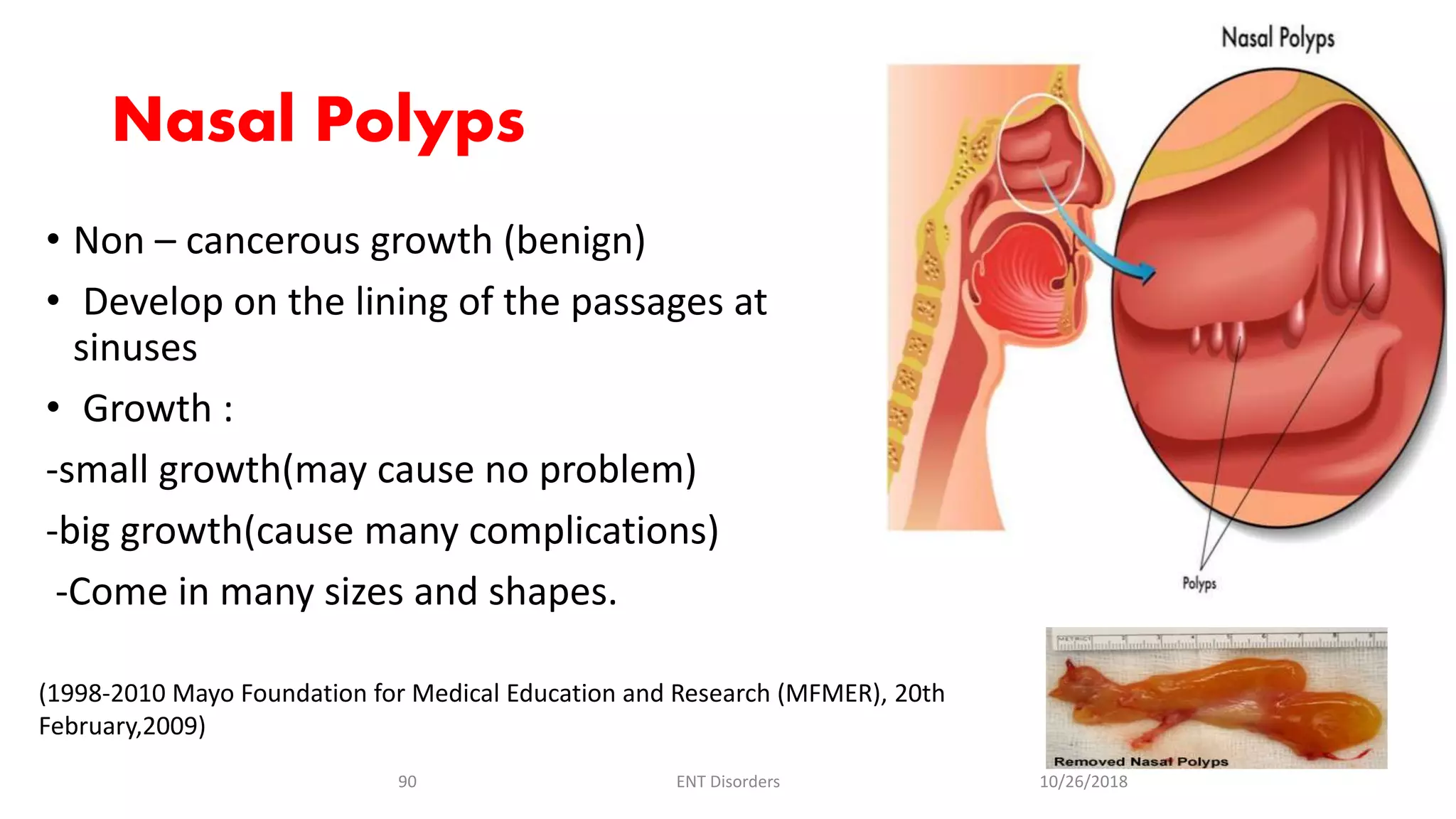 Ent disorders | PPTX