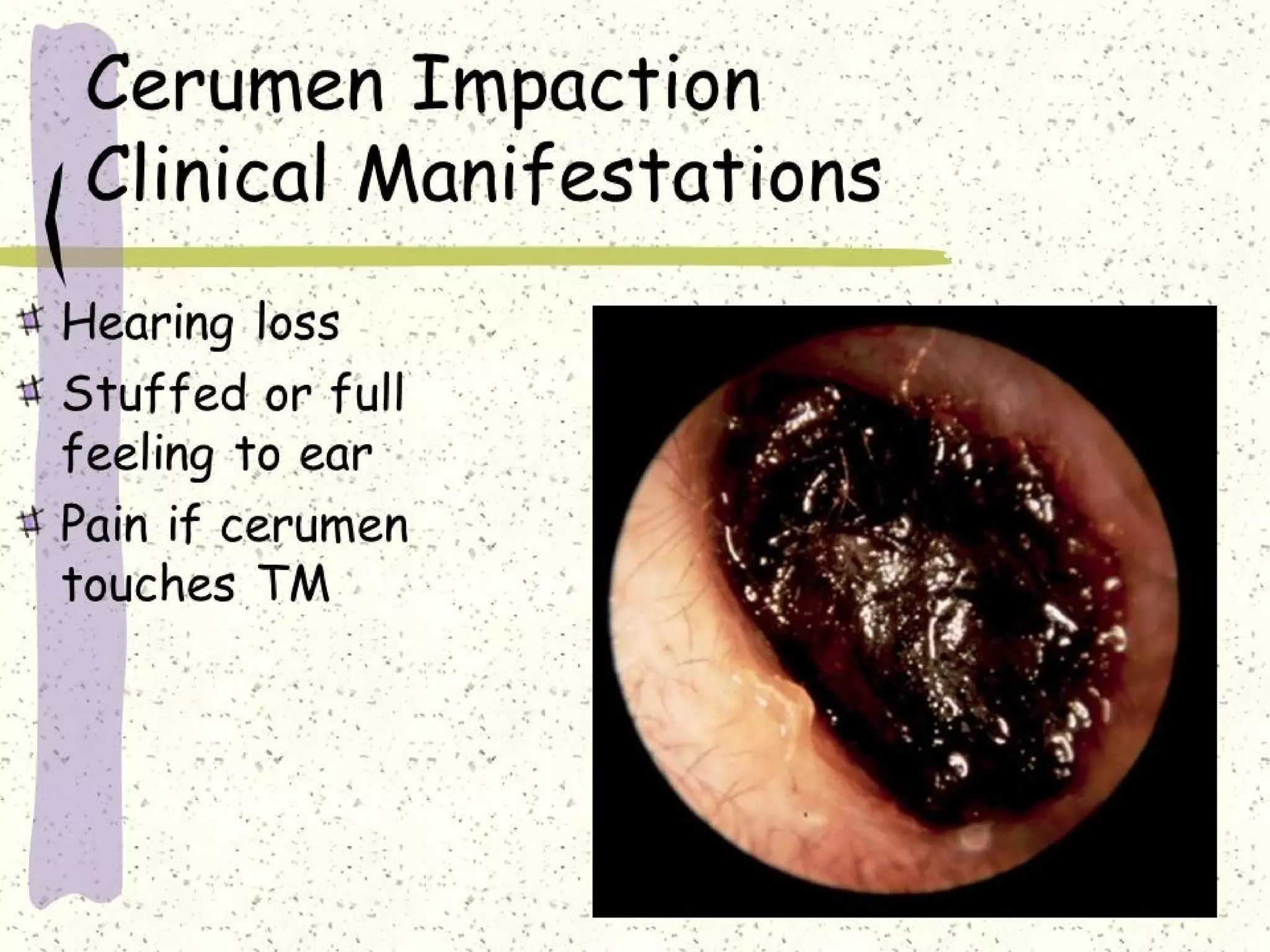 Ear,Nose and throat Disorders... | PPT
