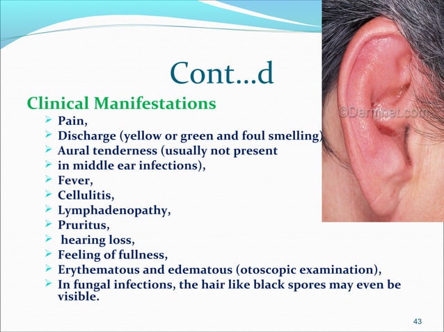 Ear,Nose and throat Disorders... | PPT