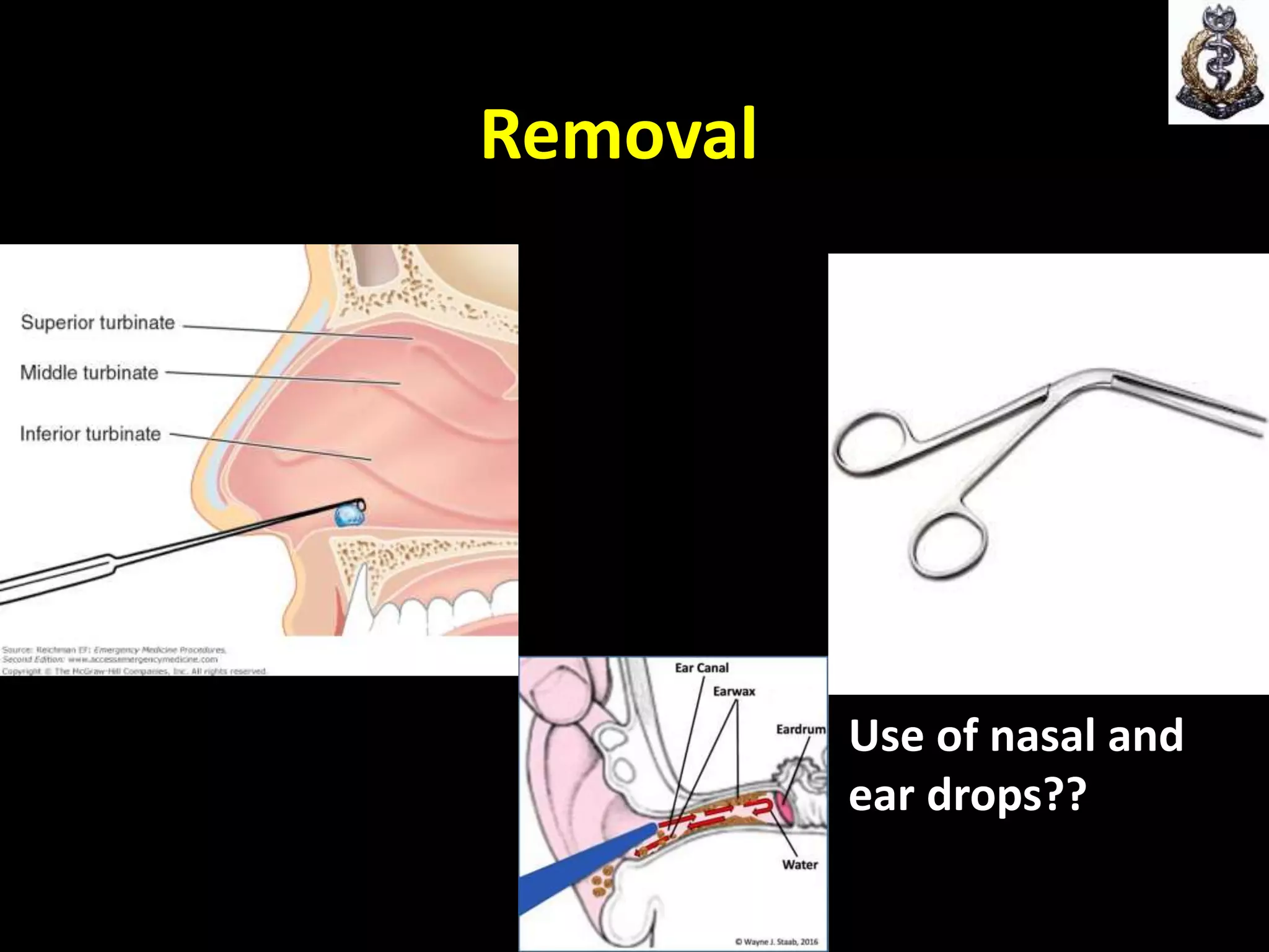 ENT emergencies.pptx