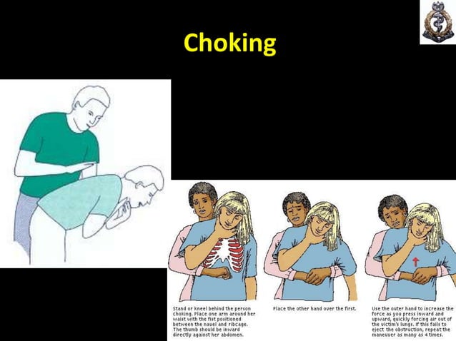 ENT emergencies.pptx | First Aid | Injuries