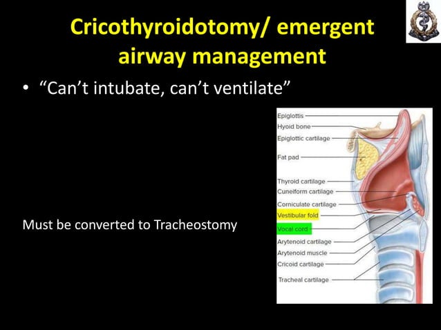 ENT emergencies.pptx | First Aid | Injuries