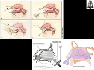 ENT emergencies.pptx