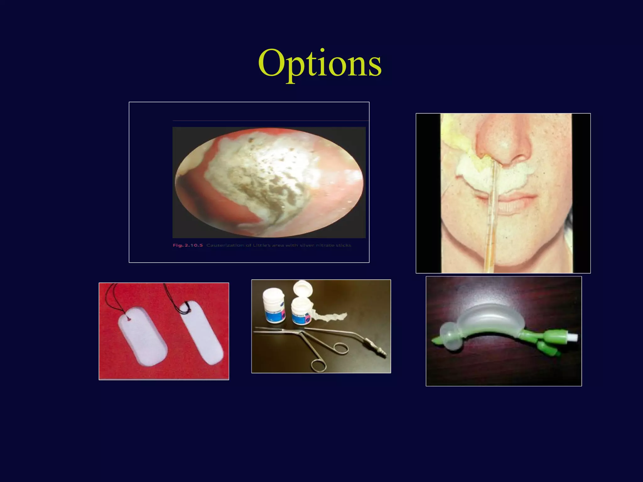 Common ENT casualties / emergencies and management strategies | PPT