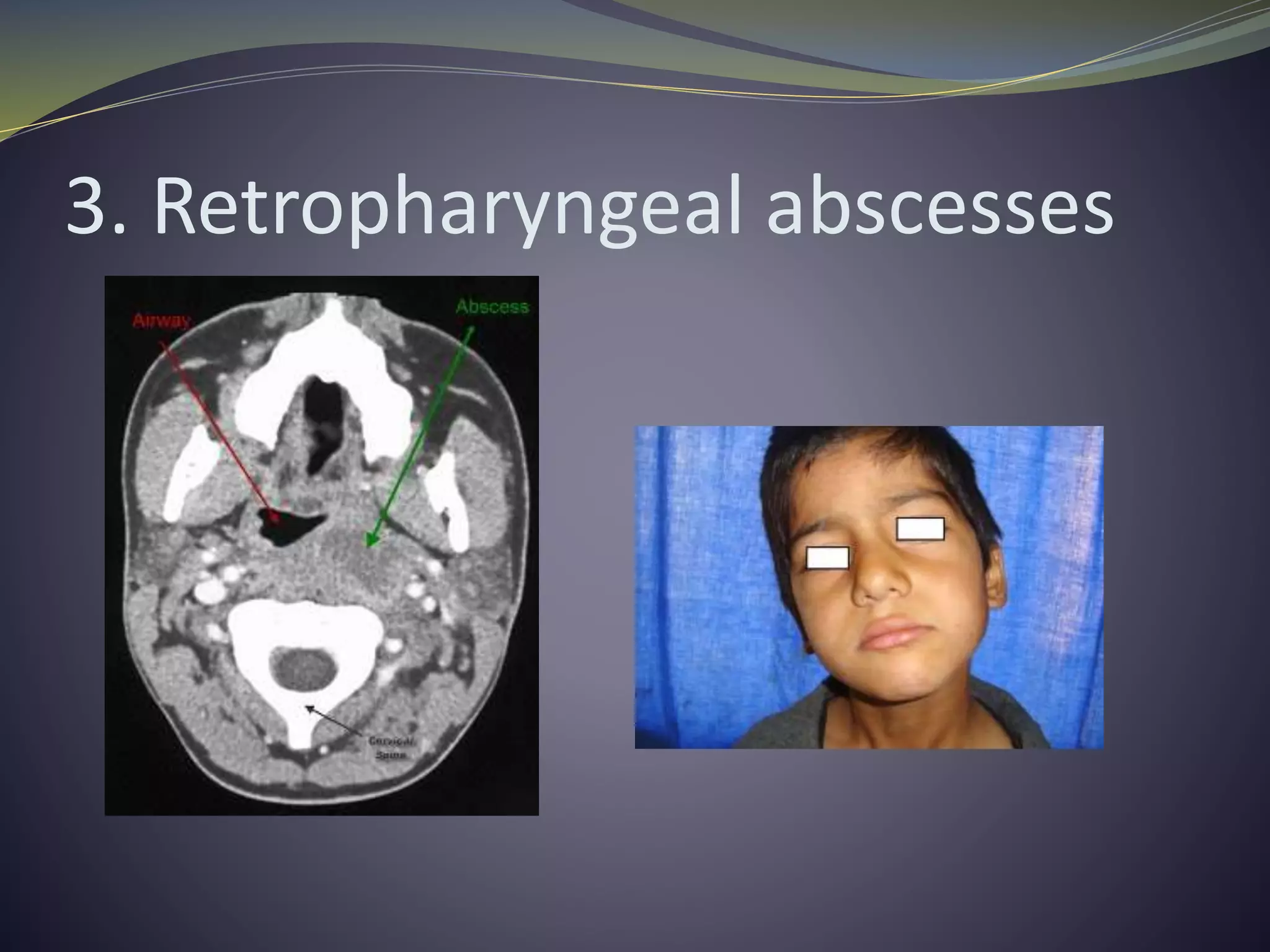 ENT emergencies | PPTX