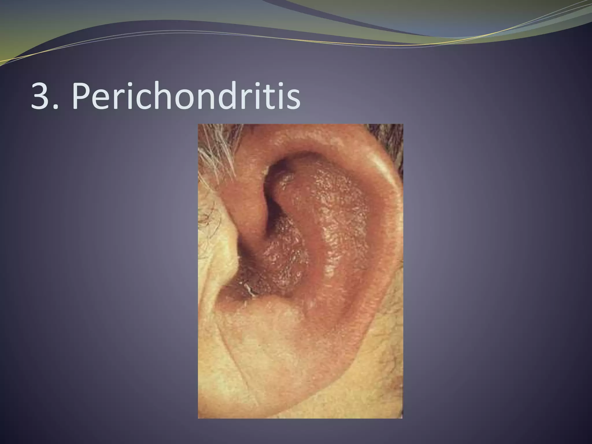 ENT emergencies | PPTX
