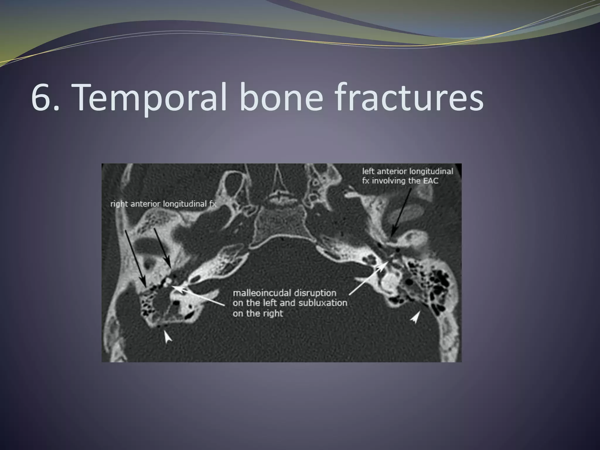 ENT emergencies | PPTX