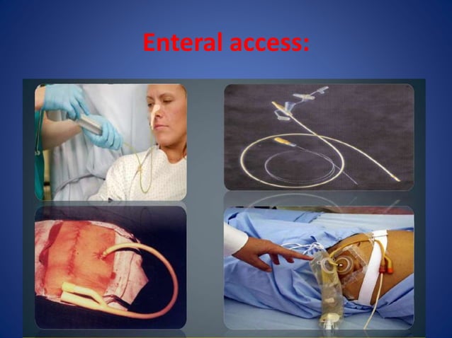 Enteral and Parenteral Nutrition | PPTX