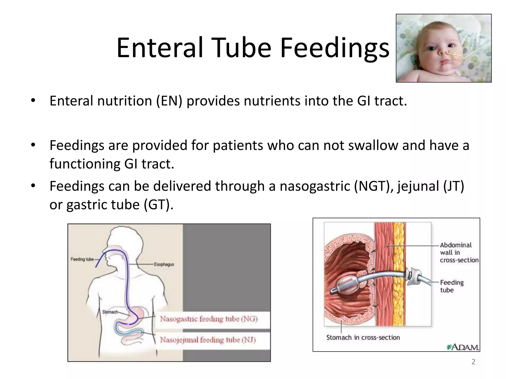enteral and parenteral nutrition.pptx