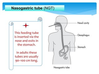 Enteral Feeding Tubes for Drug Administration | PDF