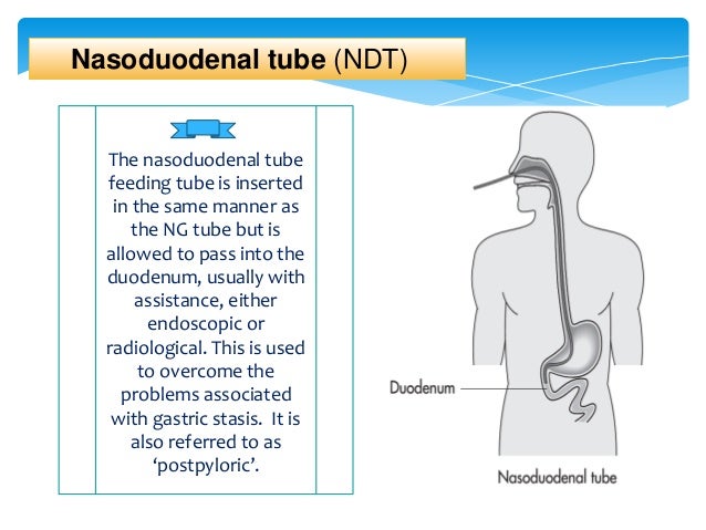 Enteral Feeding Tubes for Drug Administration