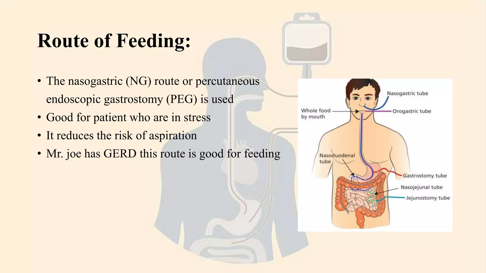 ENTERAL NUTRITION.pptx