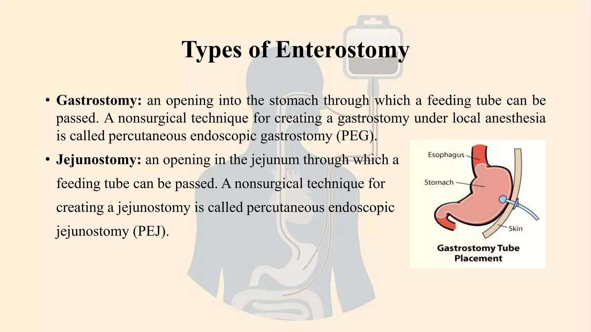 ENTERAL NUTRITION.pptx