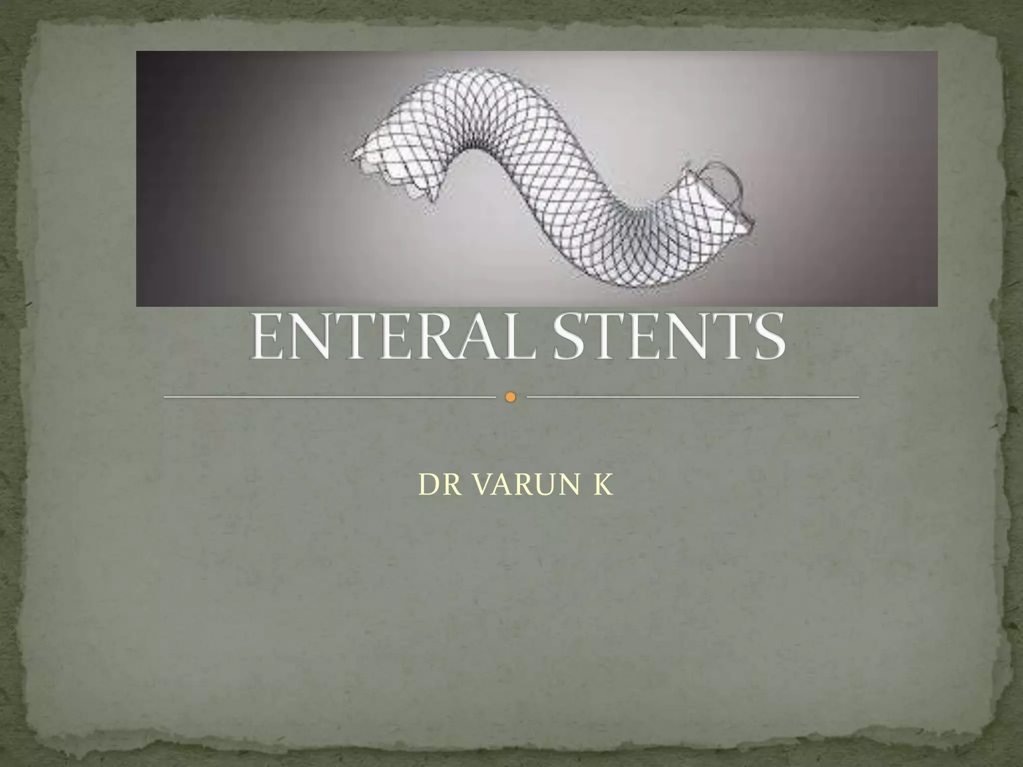 Enteral stents | PPTX