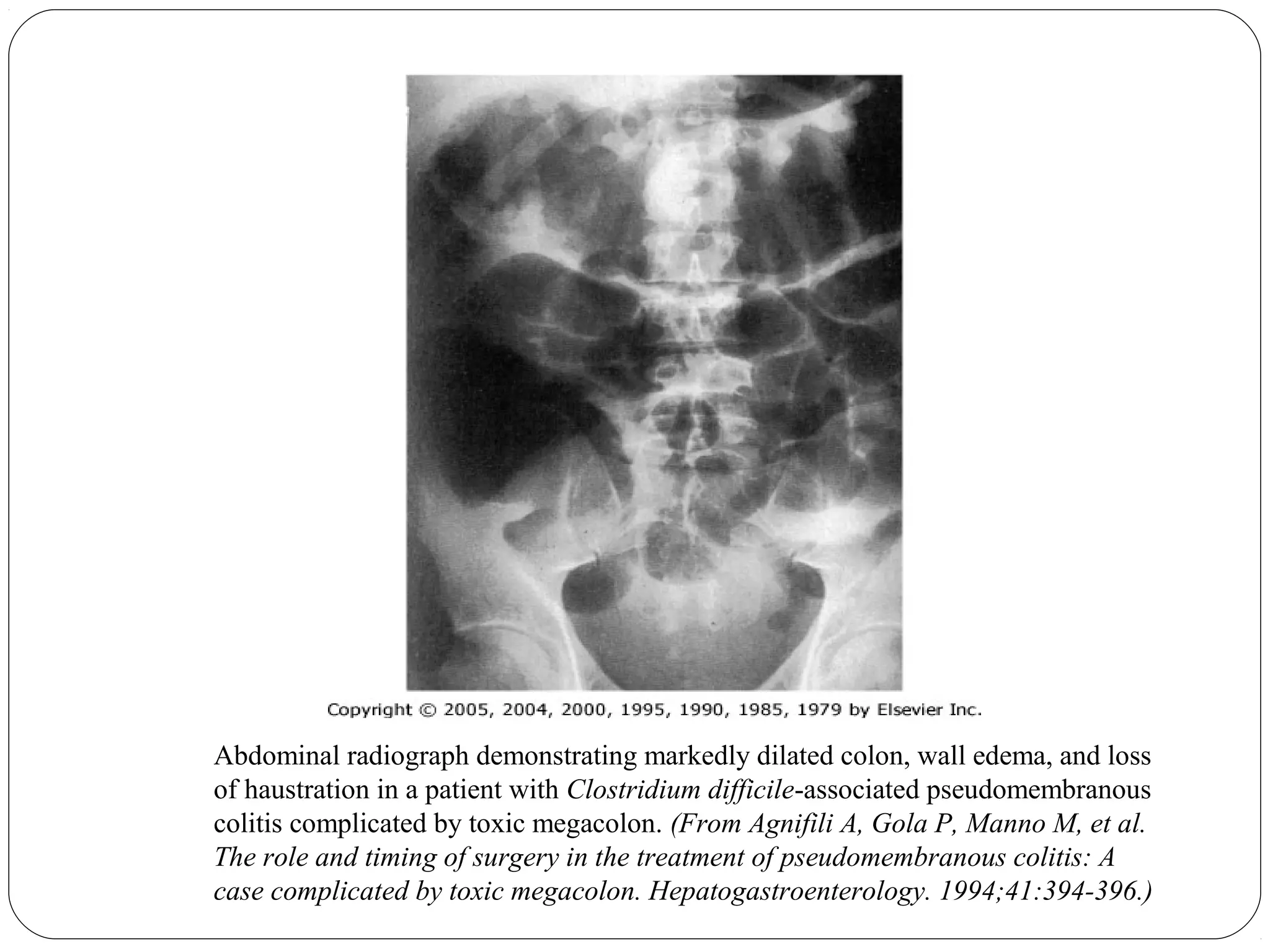 Enteric infections Mohammad Aboelmagd | PPT