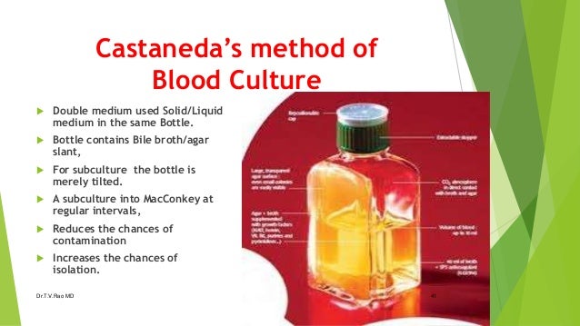 Enteric fever