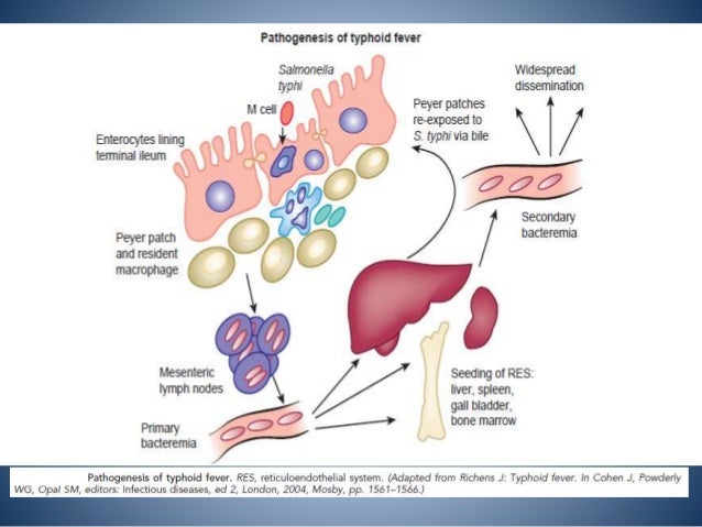 Enteric fever in children