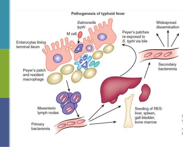 Enteric fever and its management