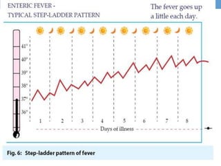 Enteric fever | PPTX