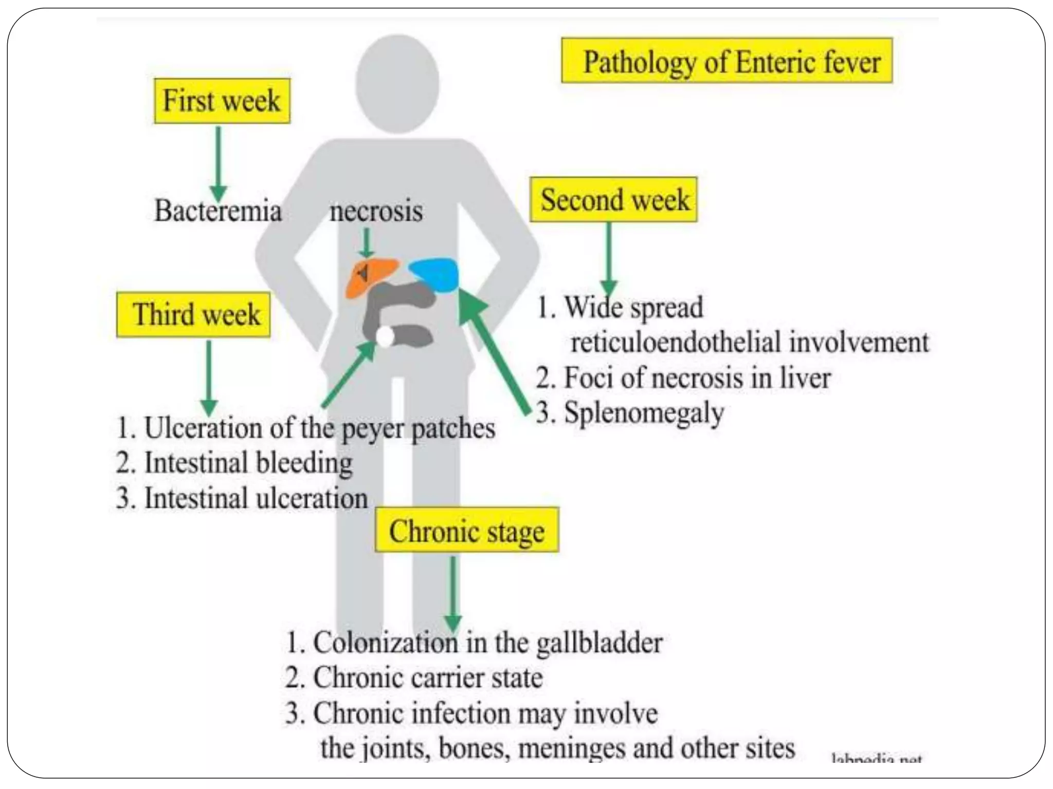 Enteric Fever.pptx