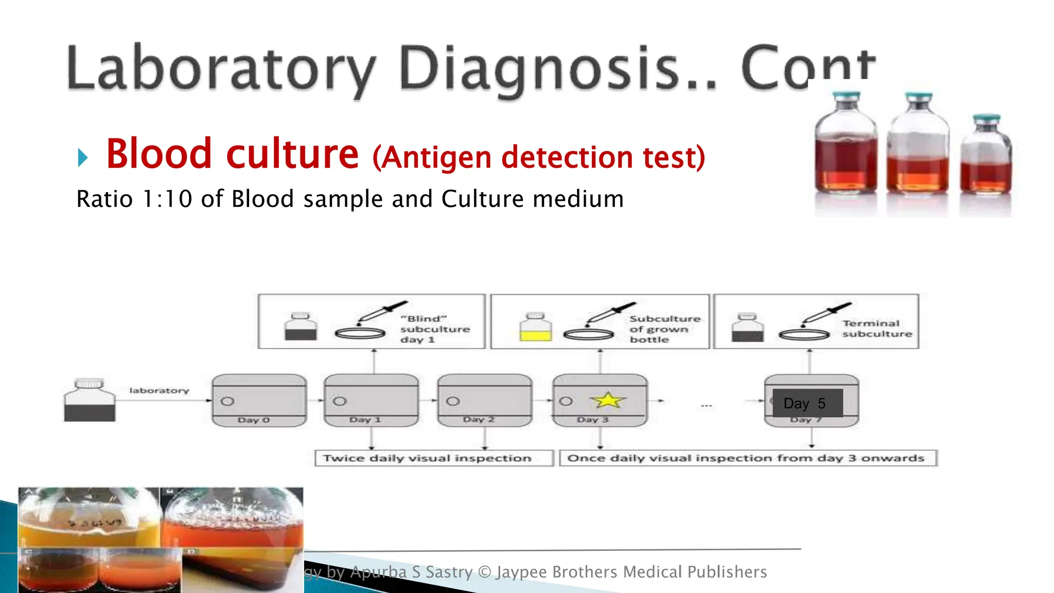 Enteric fever pathogenesis, clinical features and lab diagnosis .pptx