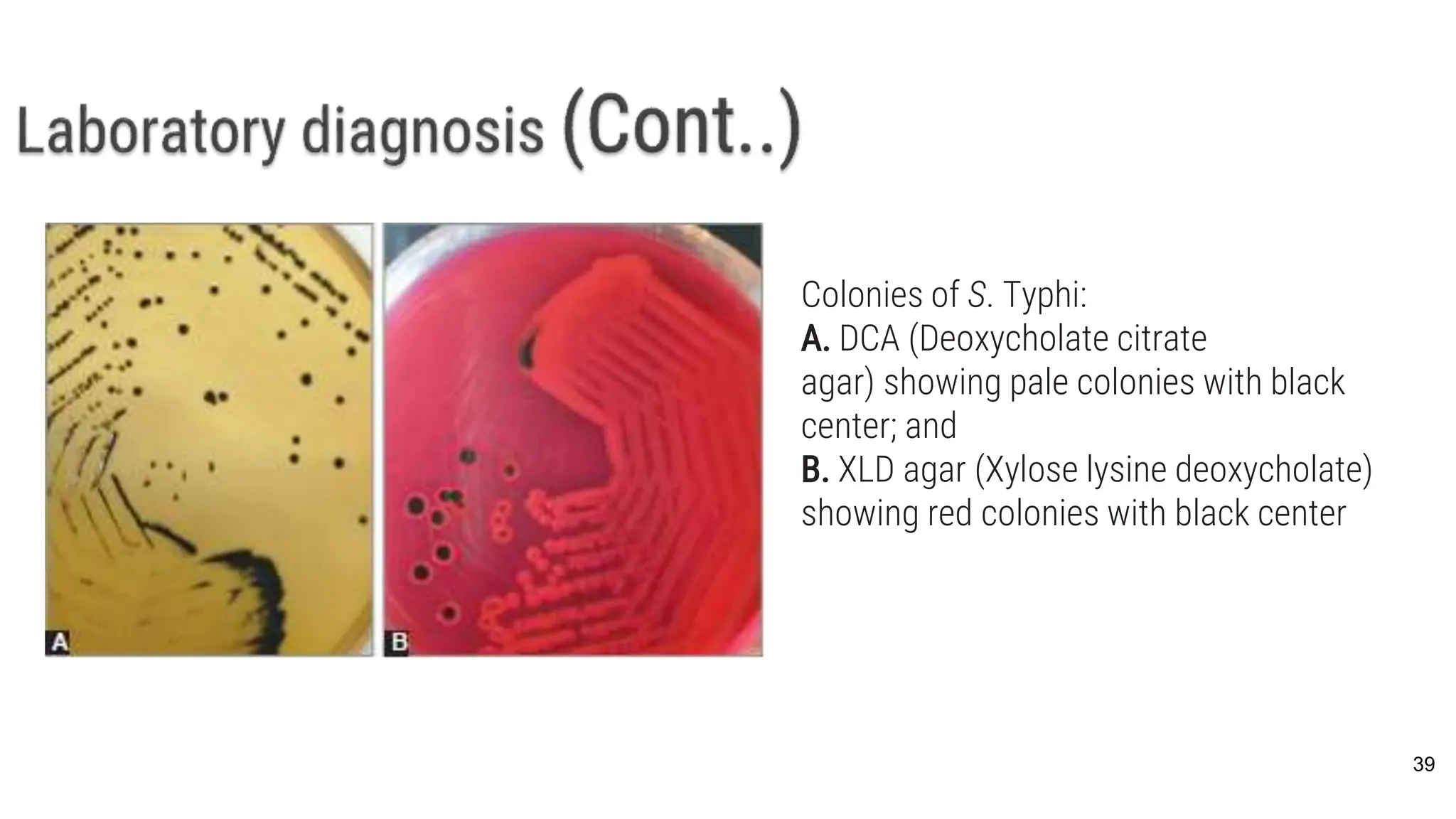 Enteric fever pathogenesis, clinical features and lab diagnosis .pptx