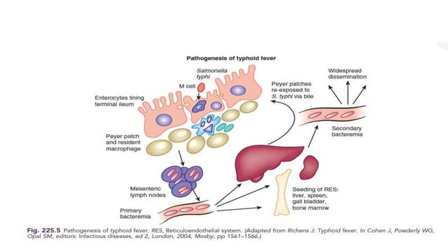 Enteric fever pathogenesis, clinical features and lab diagnosis .pptx ...