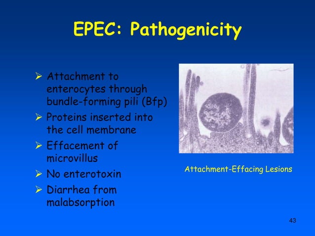 Enteric infection and food poisoning | PPT