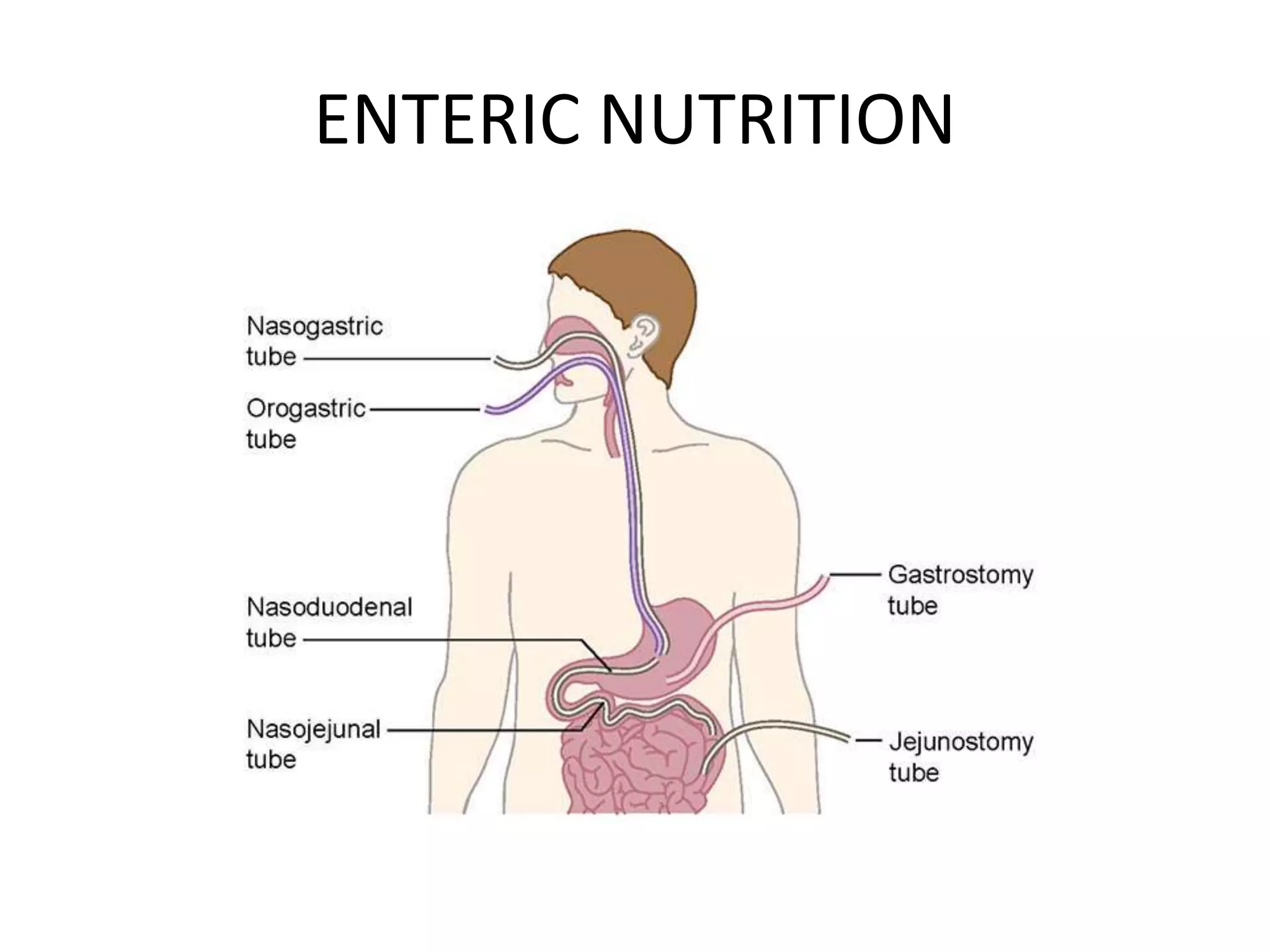 Enteric nutrition part 1 ( In Maxillofacial, Head and Neck Surgery ) | PPTX
