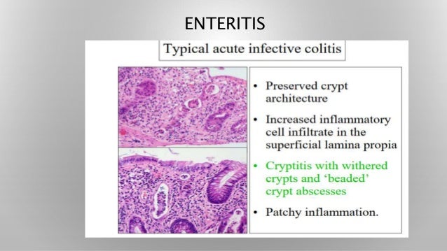 Enteritis