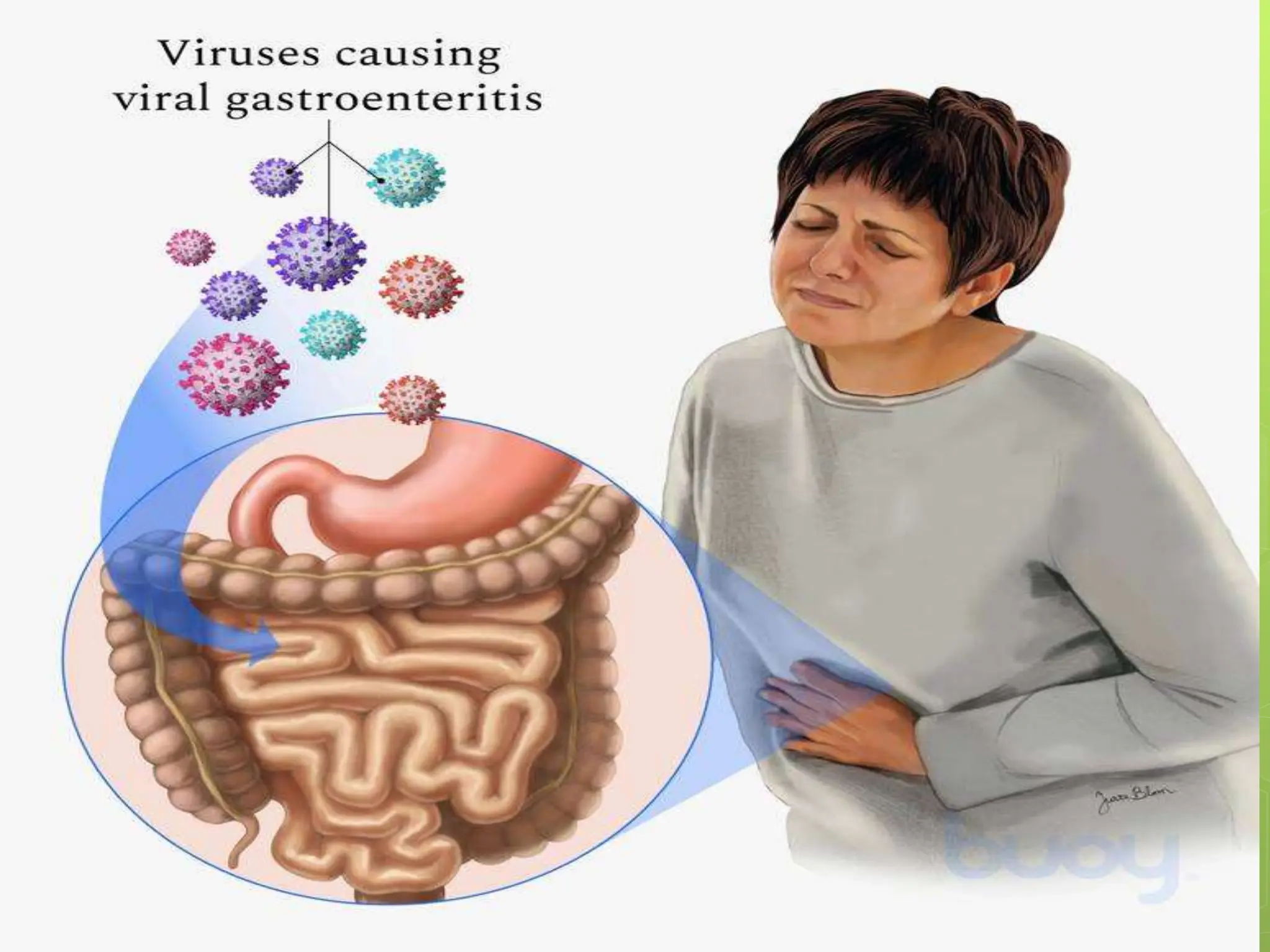 Gastro Enteritis.pptx