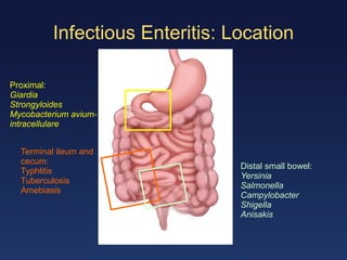 Enteritis and colitis | PDF