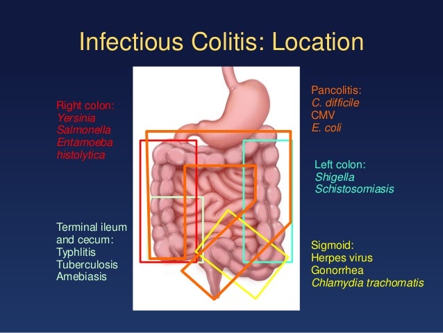 Enteritis and colitis
