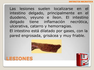 Enteritis necrotica | PPTX