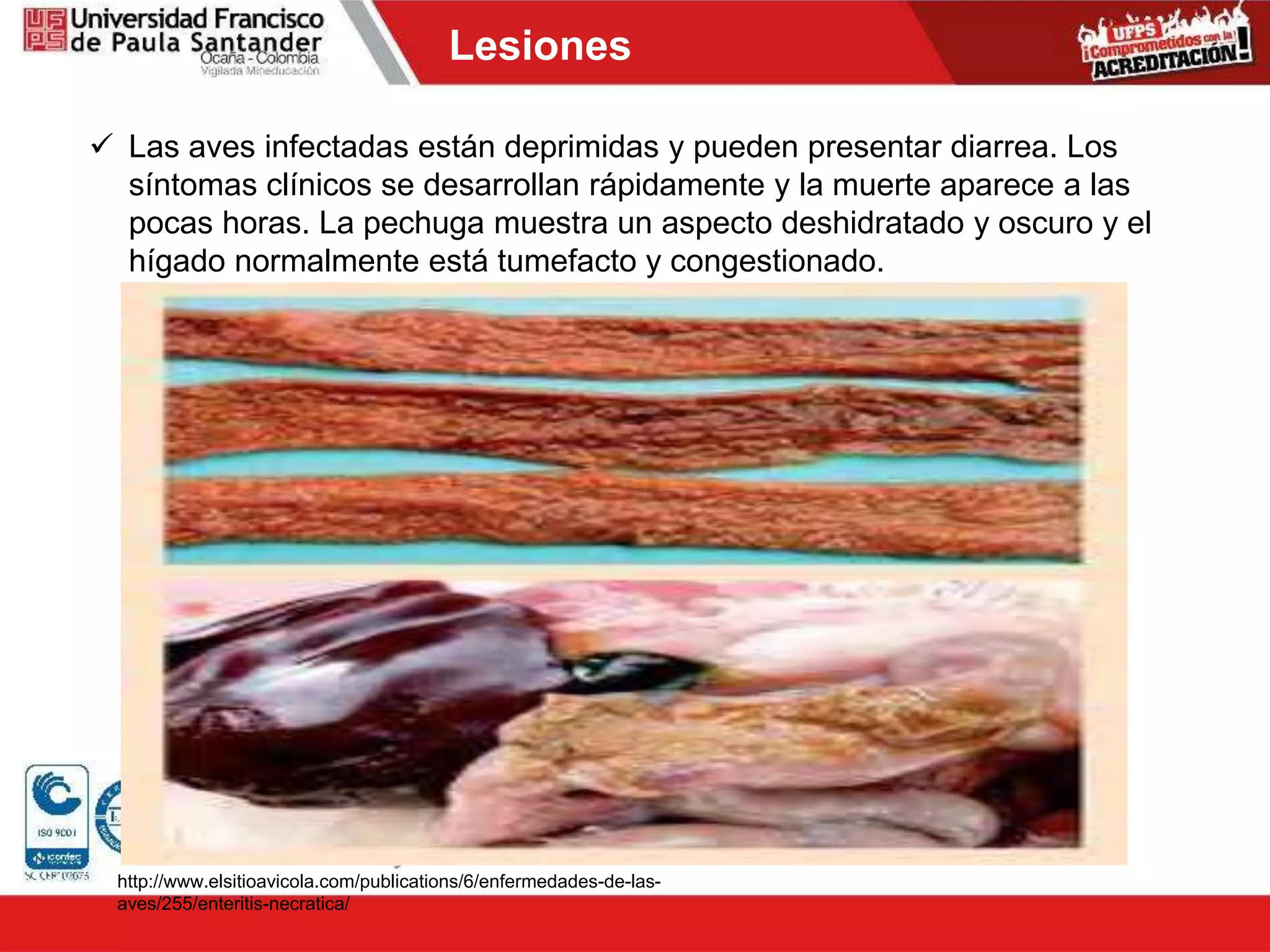 ENTERITIS NECROTICA | PPT