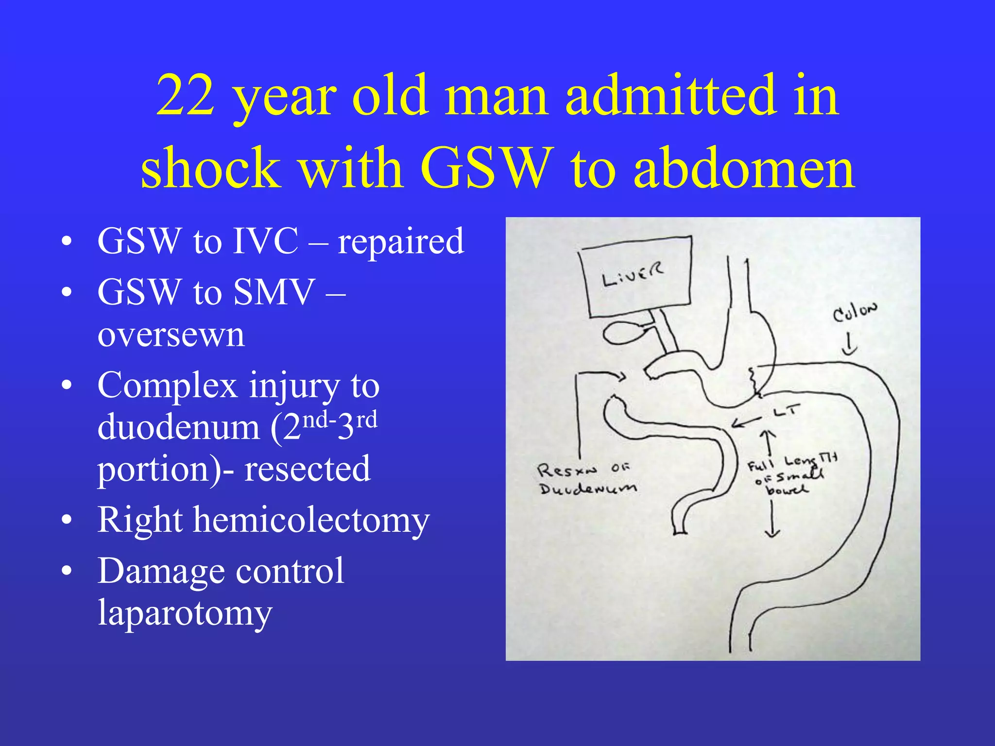 Entero-Atmospheric-Fistula, PPT.pdf