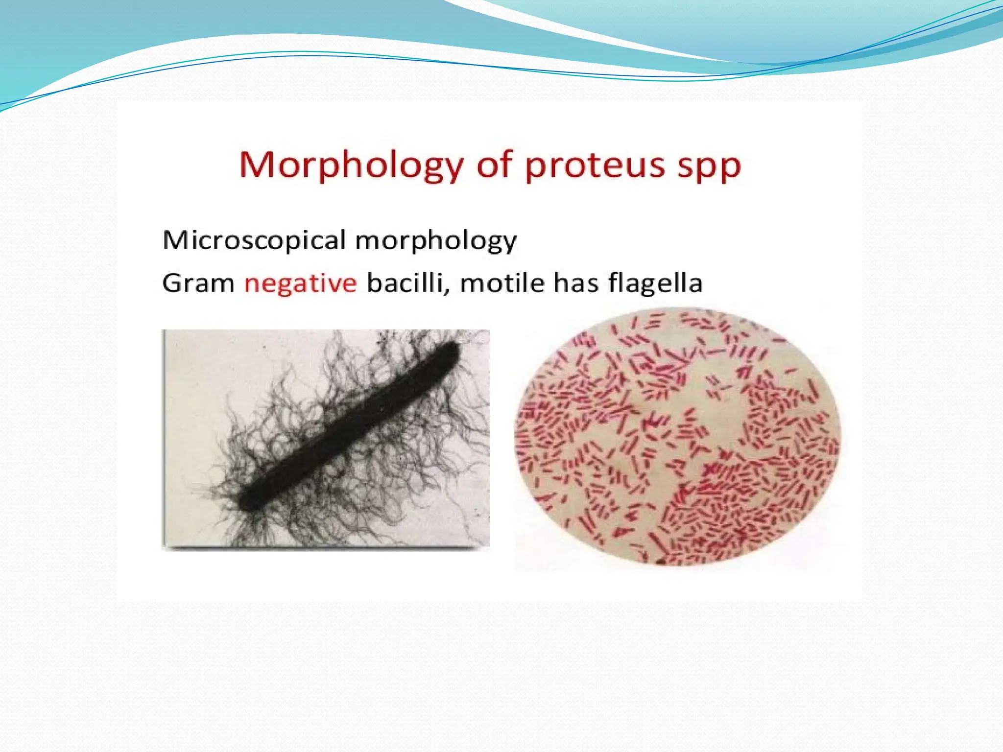 ENTEROBACTER AND PROTEOUS bacterial.pptx