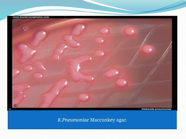 ENTEROBACTER AND PROTEOUS bacterial.pptx