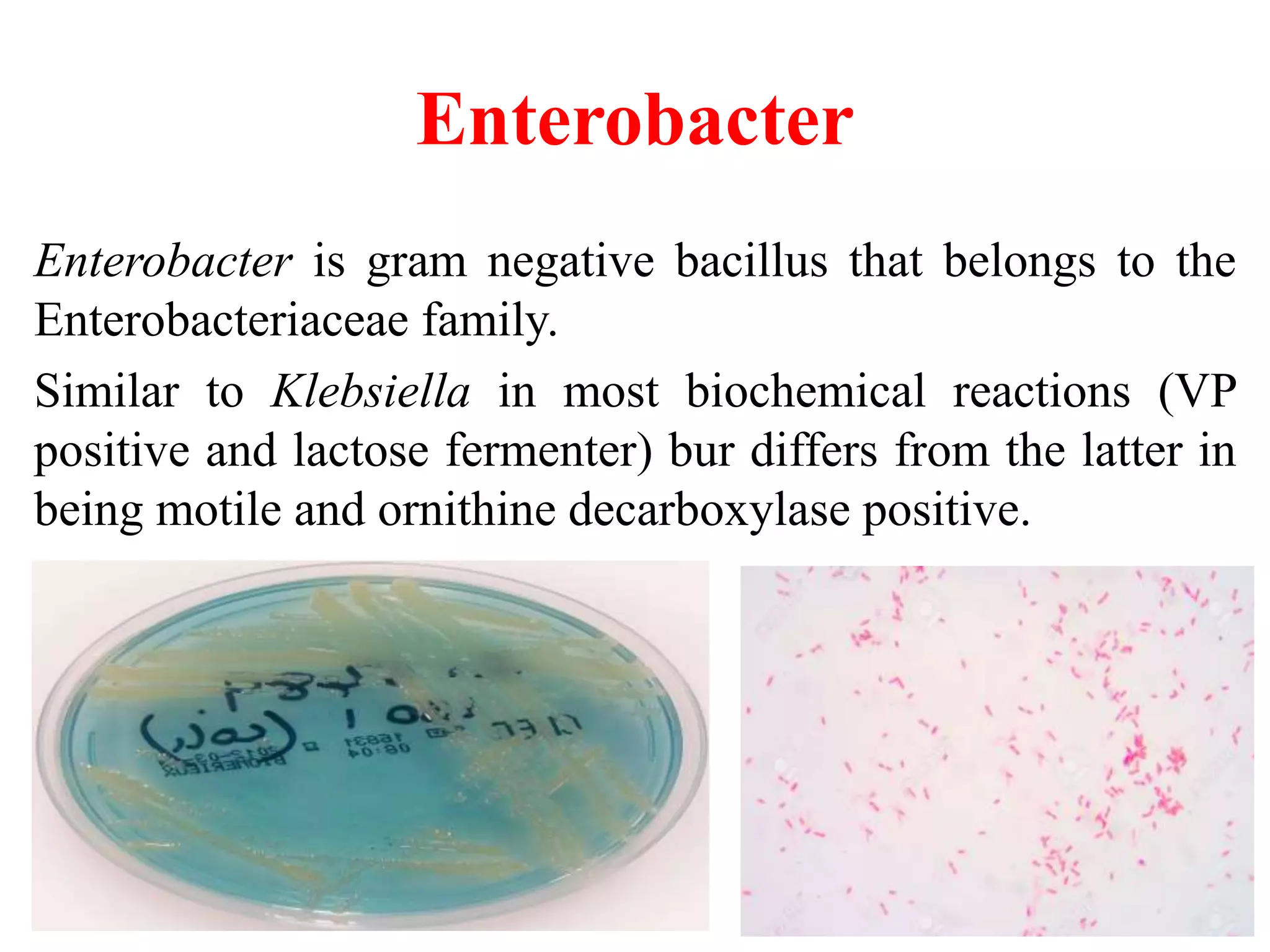 Enterobacter, hafnia & serratia (1) | PPTX