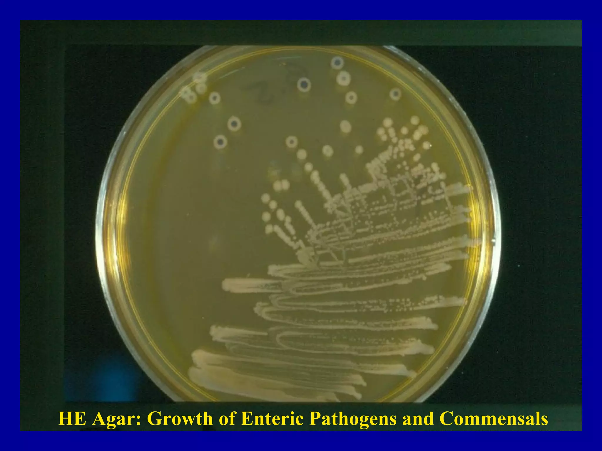 Enterobacteriaceae | PPT